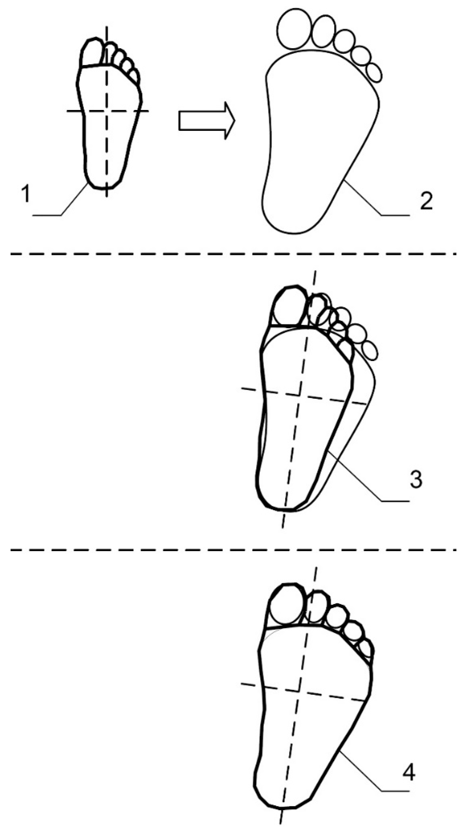 Algorithm for Automated Foot Detection in Thermal and Optical Images ...