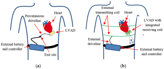 Coil Design of a Wireless Power-Transfer Receiver Integrated into a ...