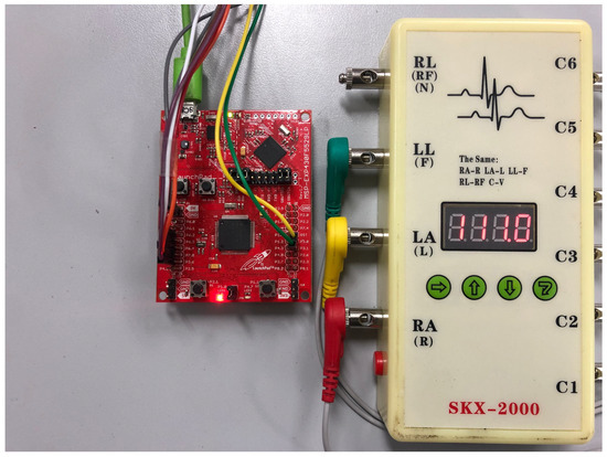 Wearable Wireless Physiological Monitoring System Based on Multi-Sensor