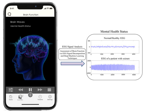 Efficacy of Smart EEG Monitoring Amidst the COVID-19 Pandemic