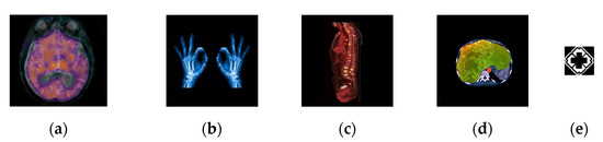 A Reversible Watermarking System for Medical Color Images: Balancing ...