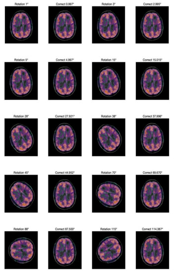 A Reversible Watermarking System for Medical Color Images: Balancing ...