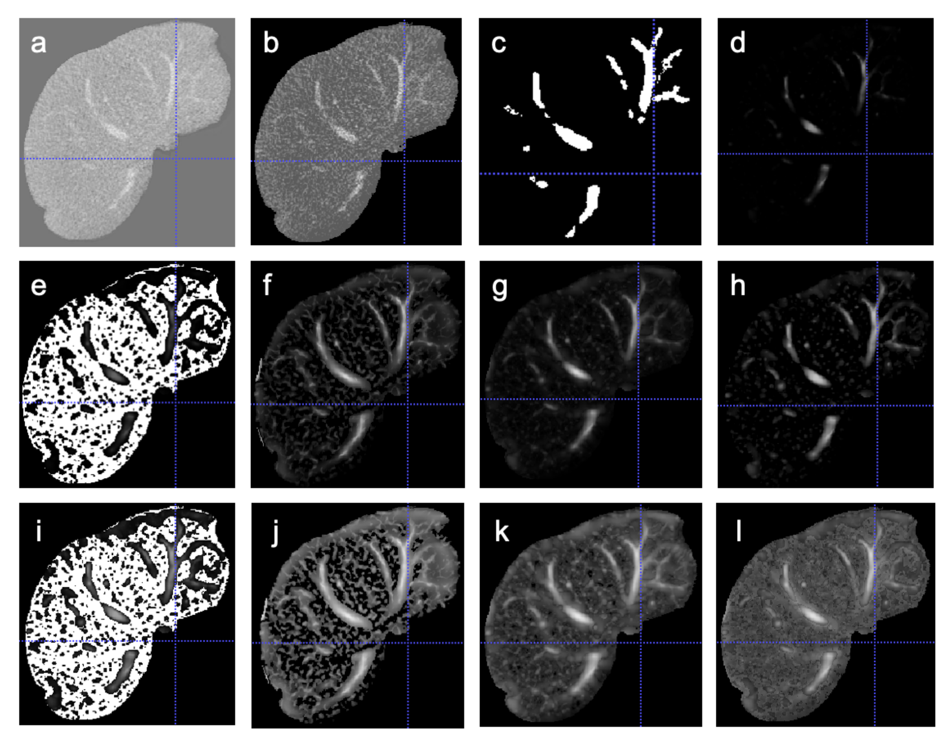 Effects of Enhancement on Deep Learning Based Hepatic Vessel Segmentation