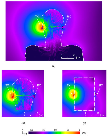 Transmission Analysis in Human Body Communication for Head-Mounted ...