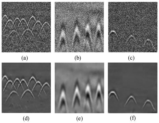 Electronics Free Full Text Gpr B Scan Image Denoising Via Multi Scale Convolutional