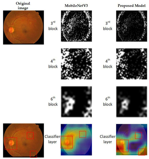 Multi-Scale Feature Fusion with Adaptive Weighting for Diabetic Retinopathy Severity Classification