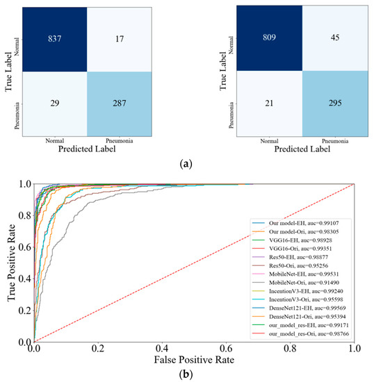 Pneumonia Detection from Chest X-ray Images Based on Convolutional ...