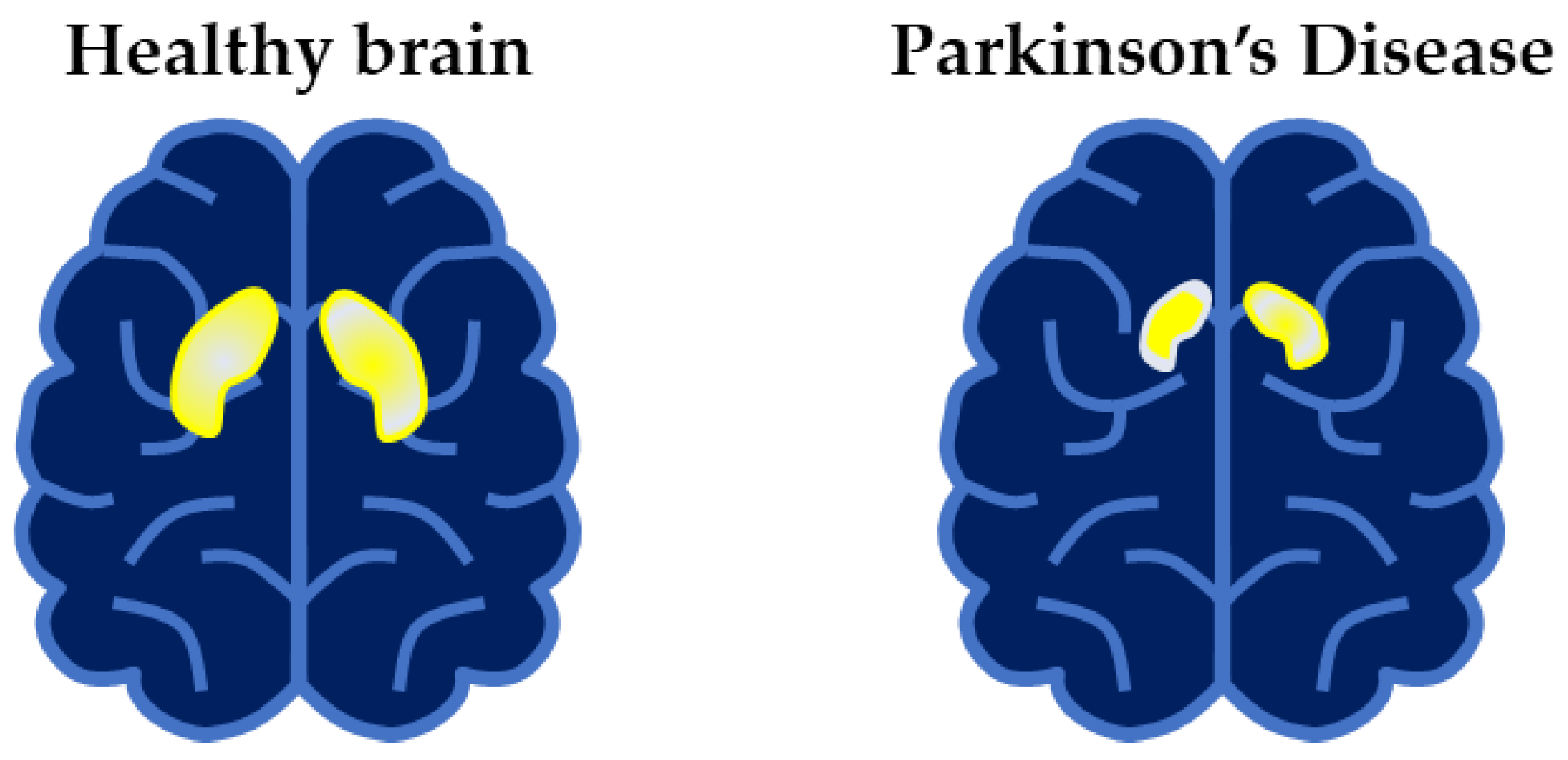 Electronics Free Full Text Gaborpdnet Gabor Transformation And Deep Neural Network For