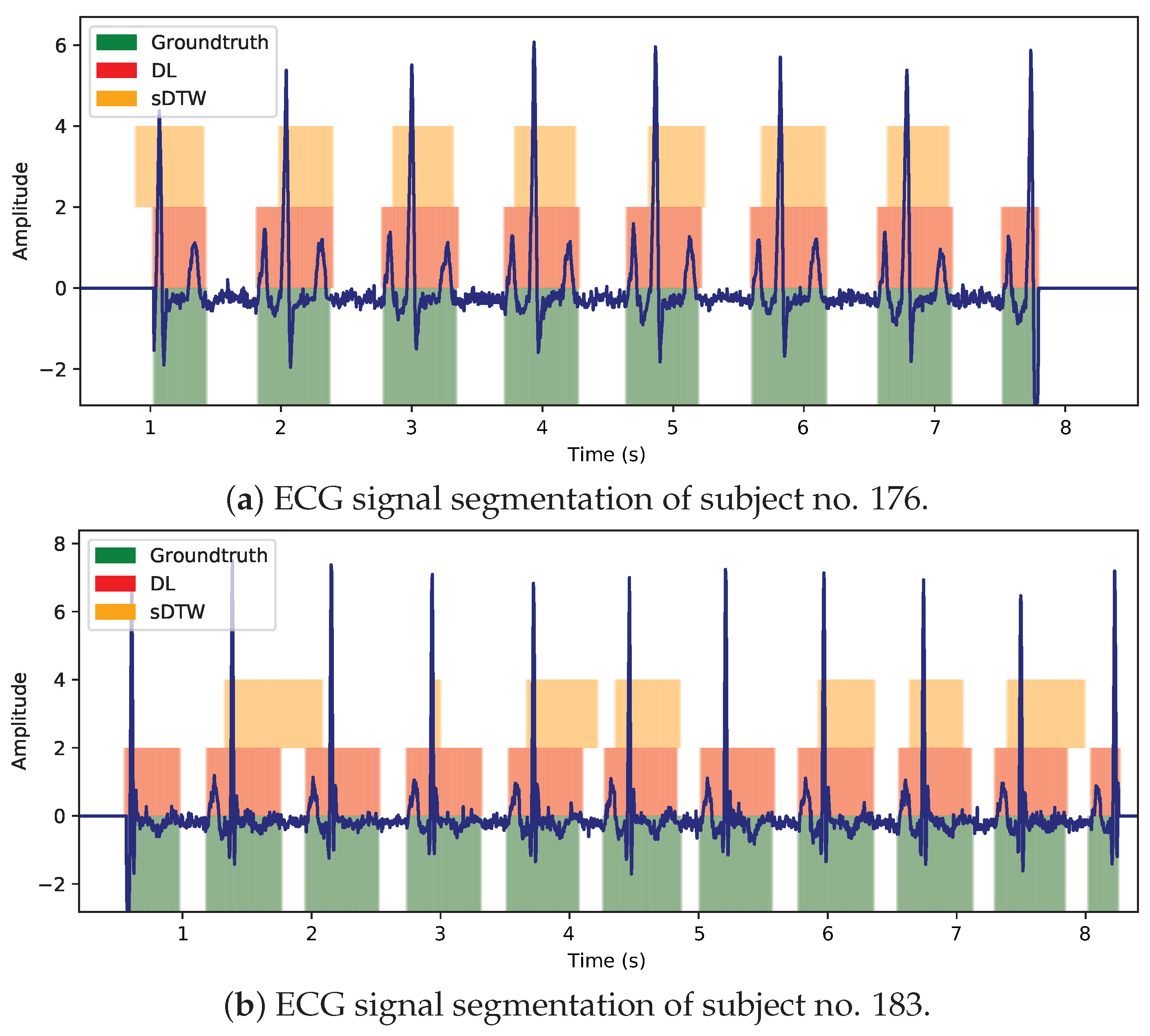 Electronics | Free Full-Text | Time Series Segmentation Using Neural ...