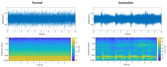 Acoustic Anomaly Detection of Mechanical Failures in Noisy Real-Life ...