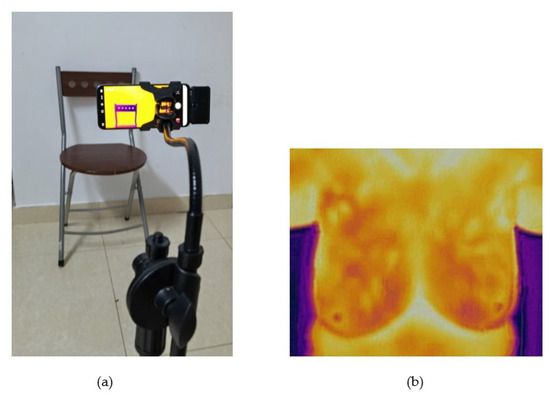 Self-Detection of Early Breast Cancer Application with Infrared Camera ...