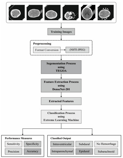 Machine Learning Model for Intracranial Hemorrhage Diagnosis and Classification