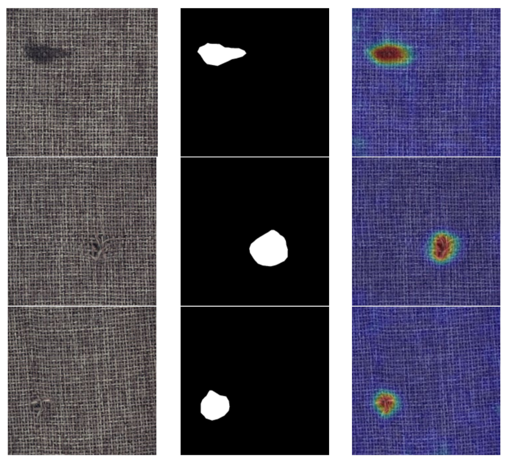Electronics | Free Full-Text | Automatic Unsupervised Fabric Defect Detection Based on Self ...