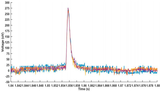 A Fully Integrated 64-Channel Recording System for Extracellular Raw ...