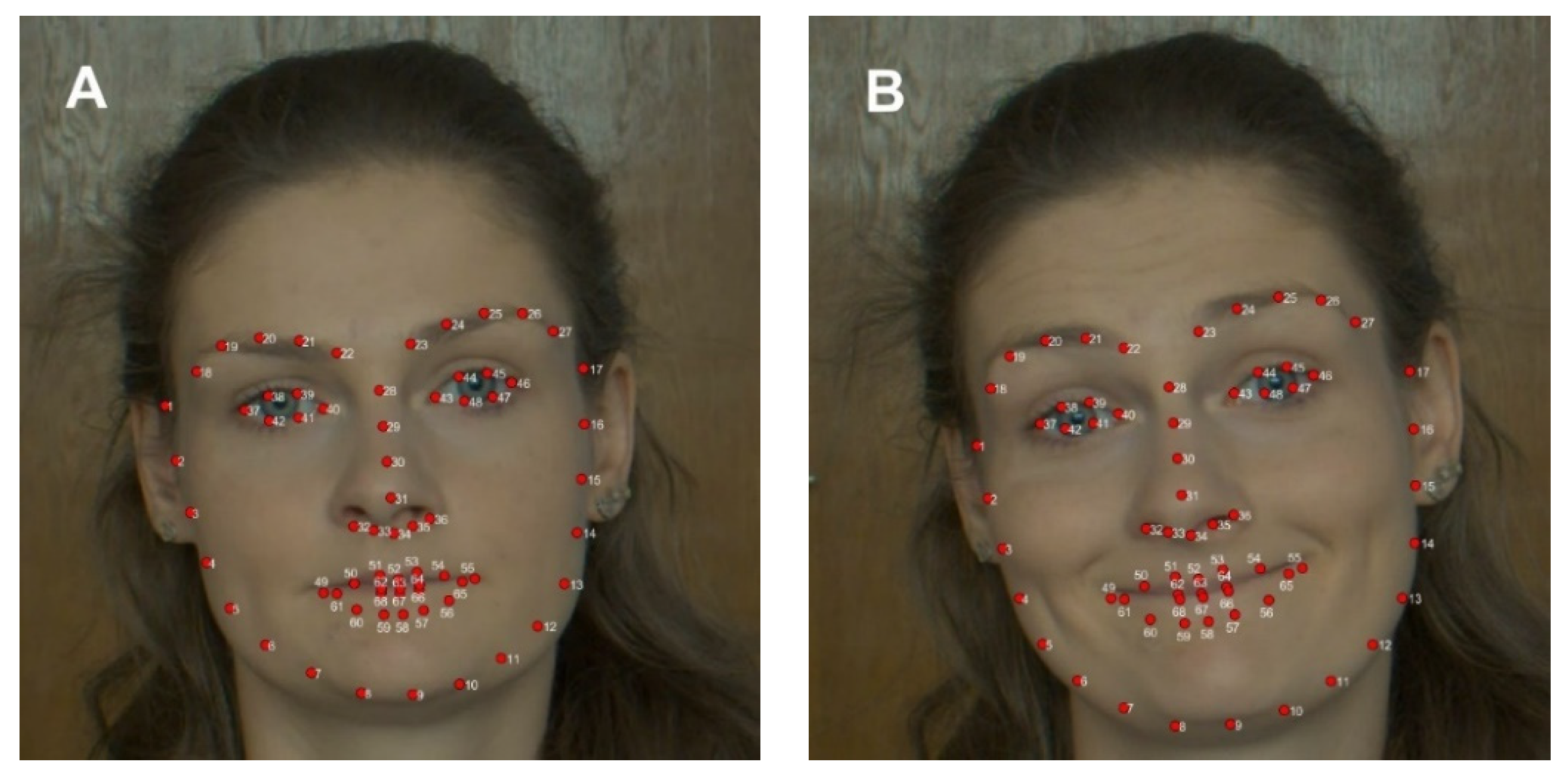 Electronics | Free Full-Text | A Study on the Possible Diagnosis of ...