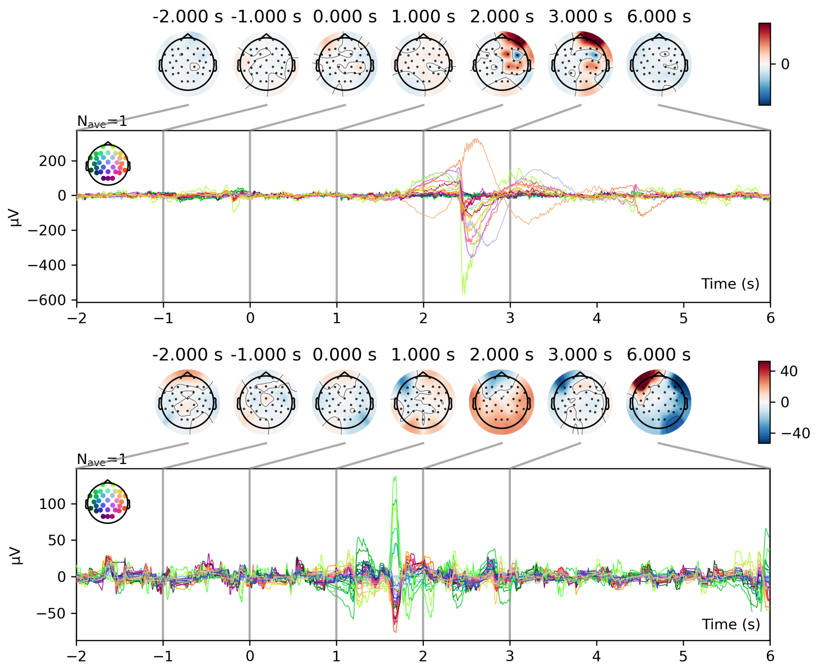 Detection of Mental Stress through EEG Signal in Virtual Reality ...