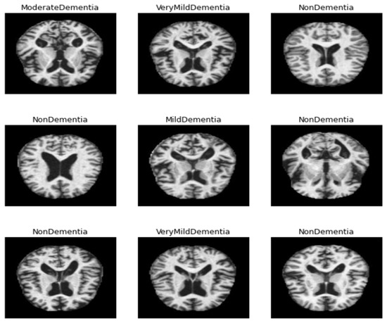 Multi-Method Analysis of Medical Records and MRI Images for Early ...