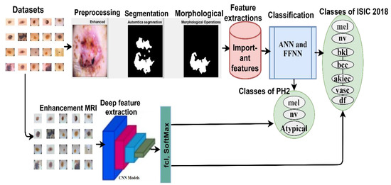 Deep Learning and Machine Learning Techniques of Diagnosis Dermoscopy Images for Early Detection ...