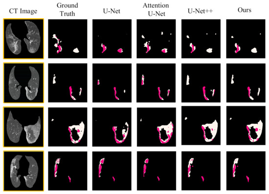 Electronics | Free Full-Text | SD-UNet: A Novel Segmentation Framework ...