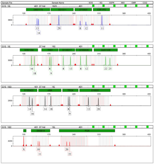 TAWSEEM: A Deep-Learning-Based Tool for Estimating the Number of ...