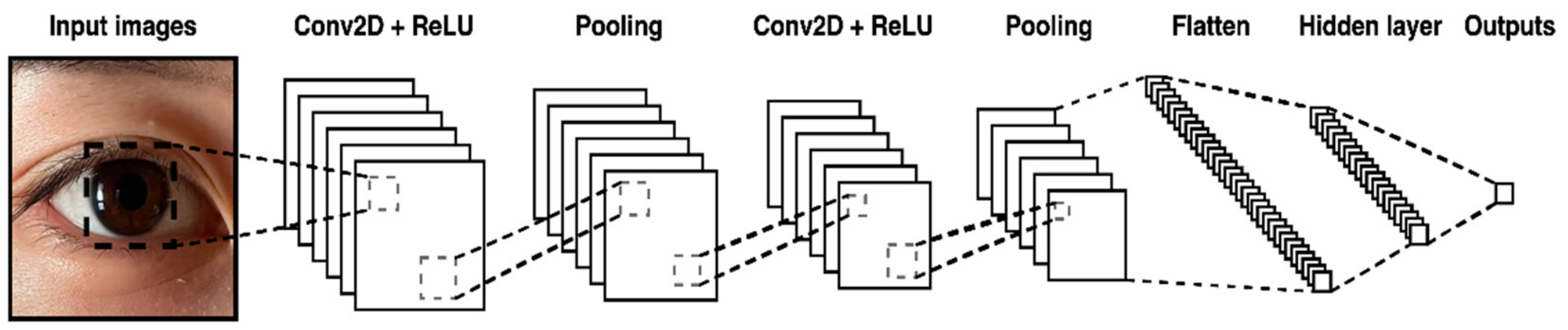 Electronics | Free Full-Text | The Use of Convolutional Neural Networks and Digital Camera ...