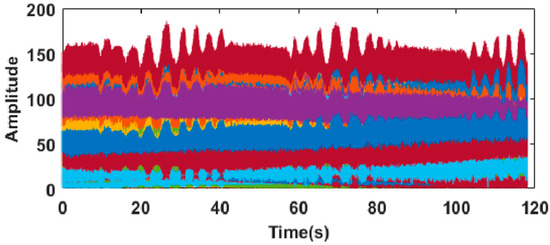 Cheyne-Stokes Respiration Perception via Machine Learning Algorithms