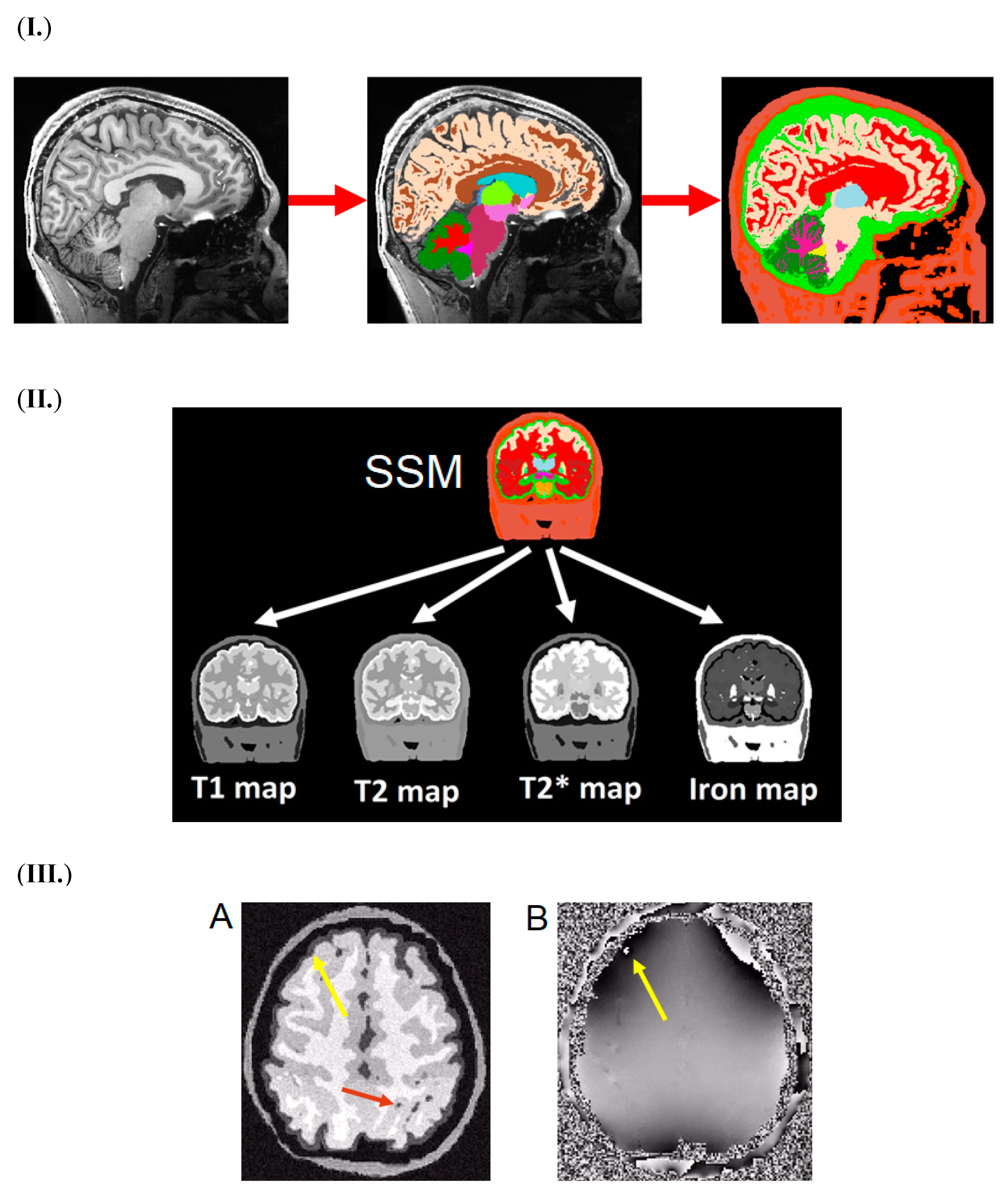 The “Coherent Data Set”: Combining Patient Data and Imaging in a ...