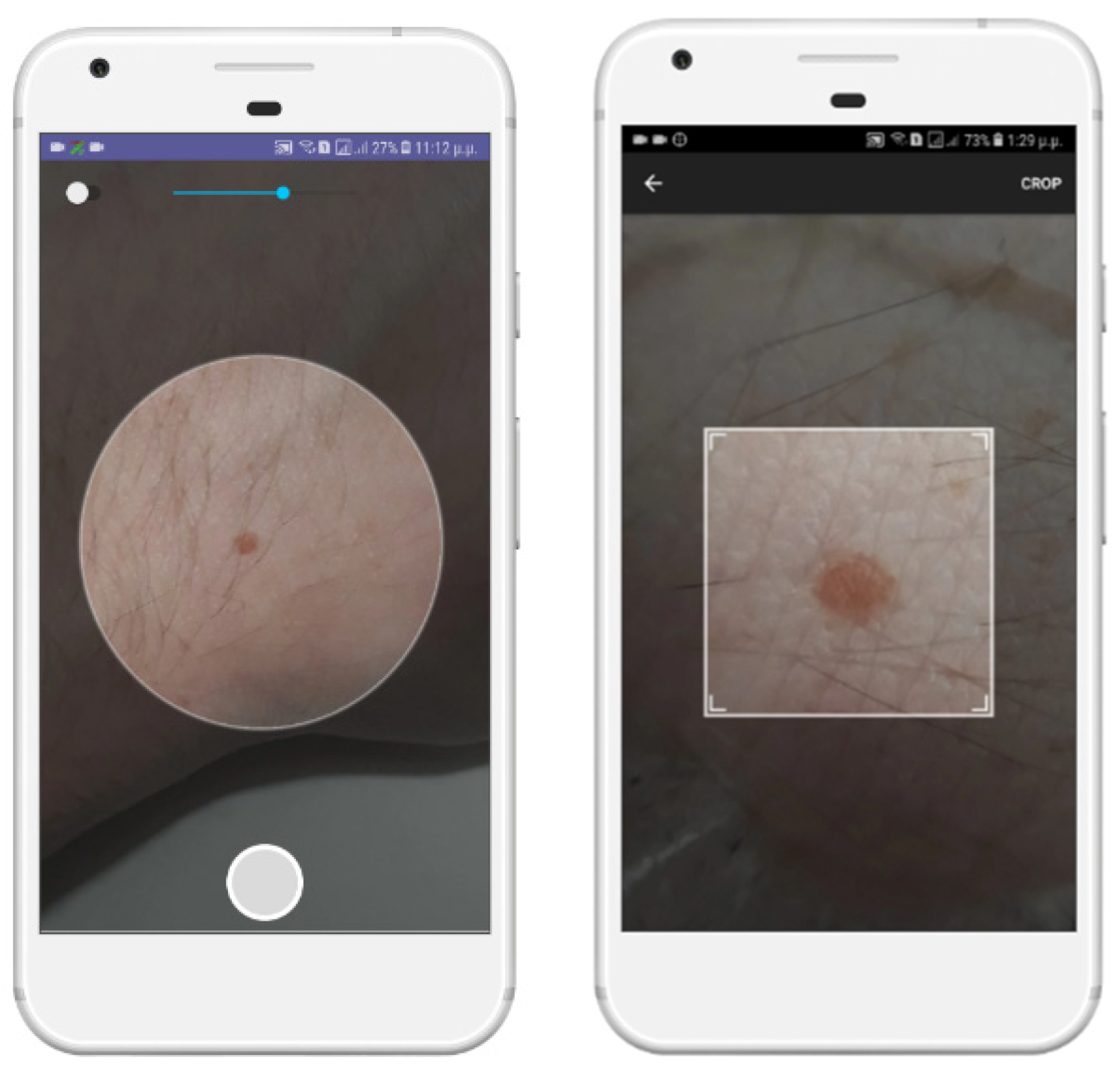 Deep Learning Methods for Accurate Skin Cancer Recognition and Mobile ...
