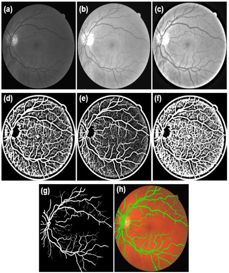 An Automated Image Segmentation and Useful Feature Extraction Algorithm ...