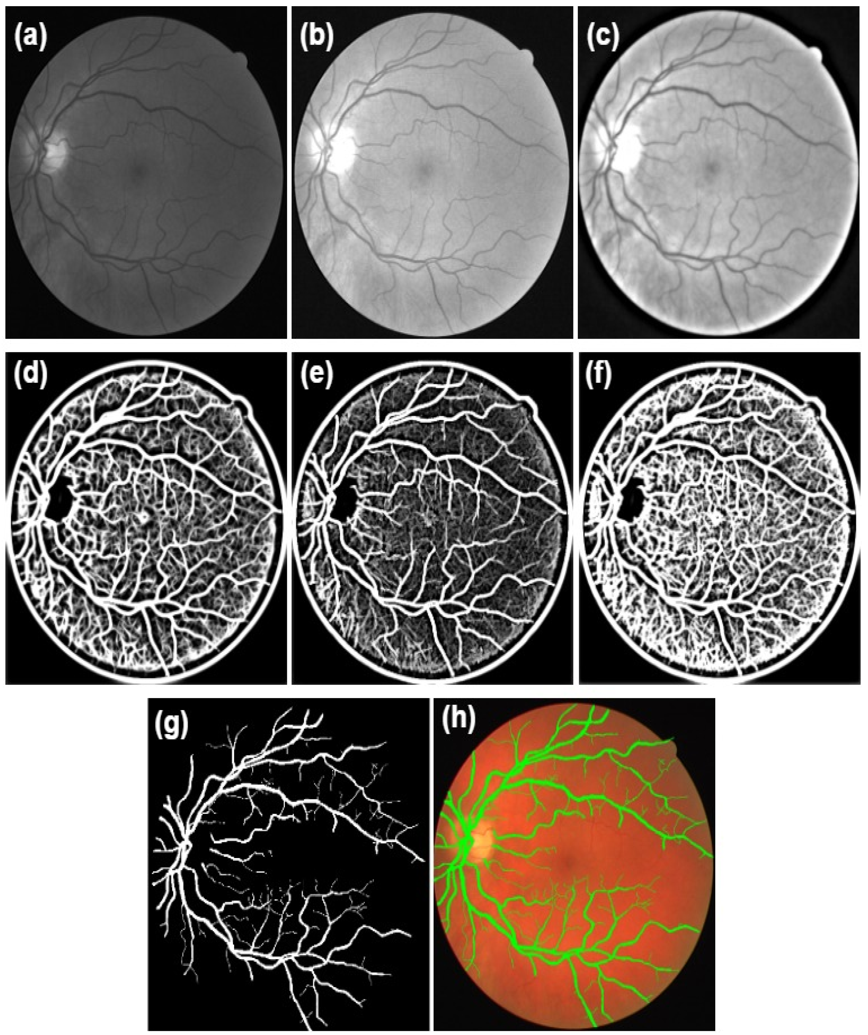 Electronics Free Full Text An Automated Image Segmentation And Useful Feature Extraction 