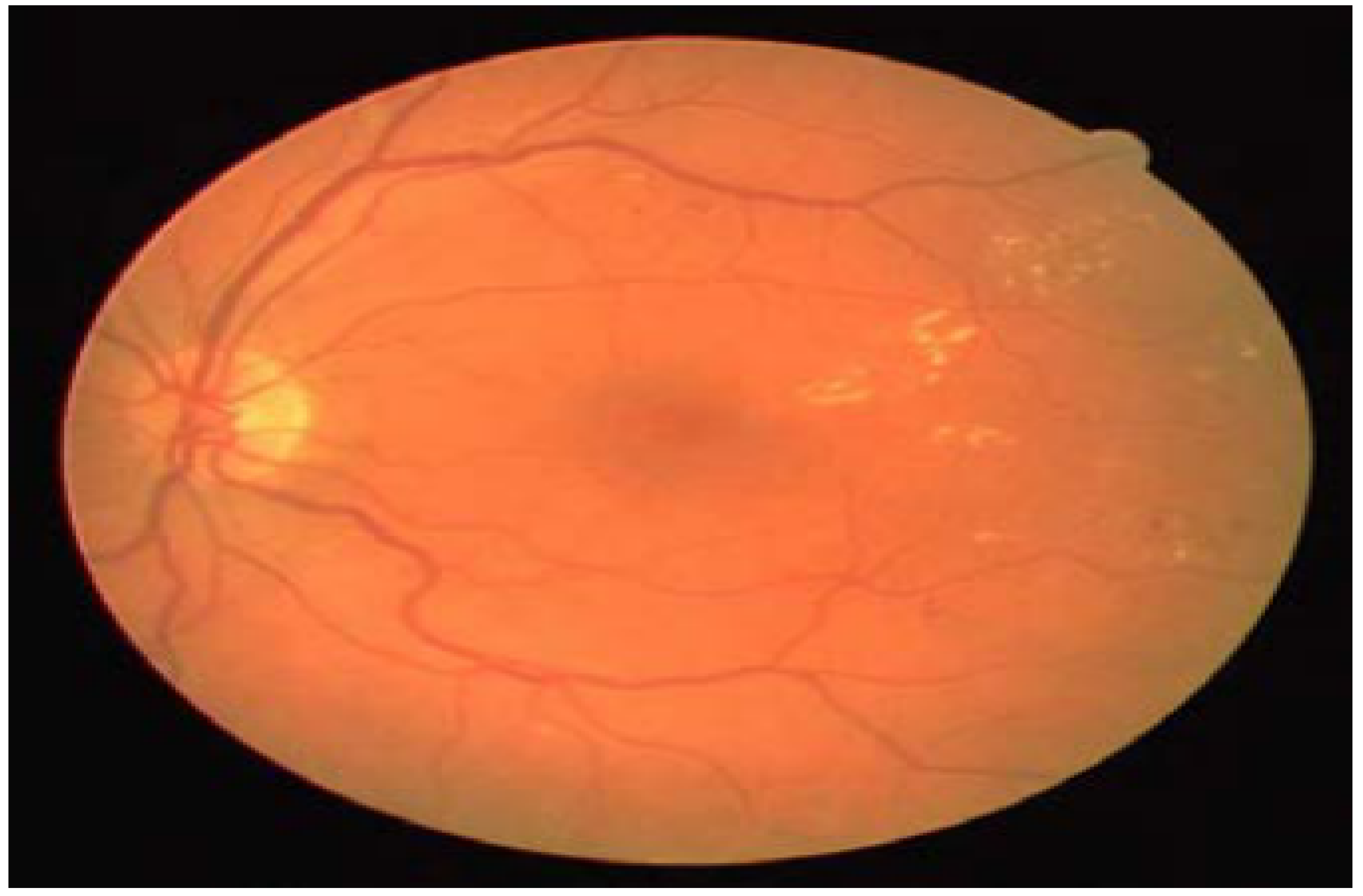 Electronics | Free Full-Text | An Automated Image Segmentation and Useful Feature Extraction ...