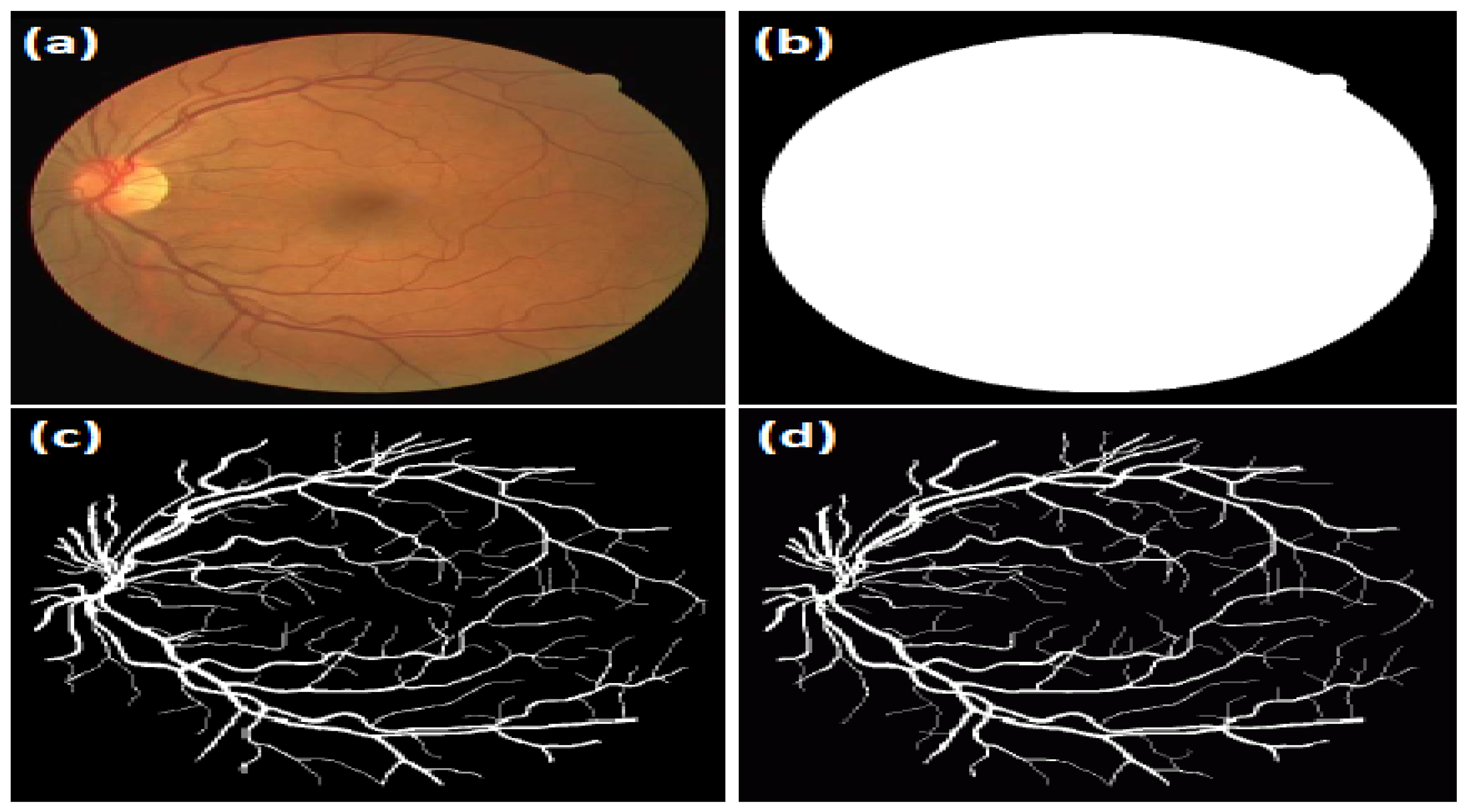 Electronics | Free Full-Text | An Automated Image Segmentation and Useful Feature Extraction ...