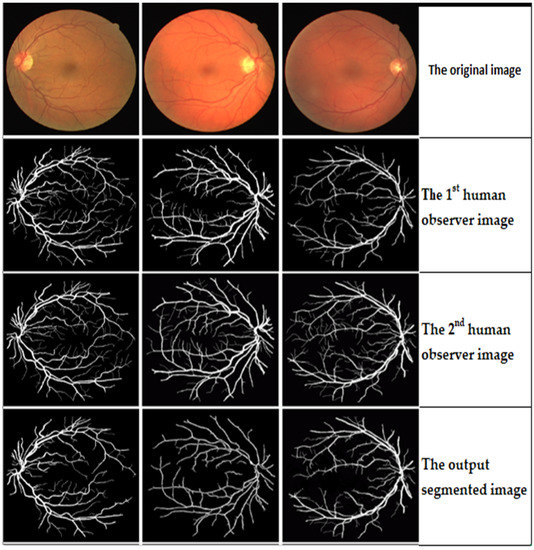 Electronics | Free Full-Text | An Automated Image Segmentation and Useful Feature Extraction ...