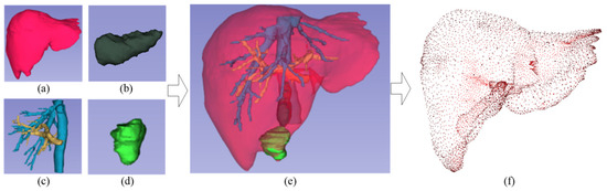 A 3D Image Registration Method for Laparoscopic Liver Surgery Navigation