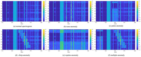 Spectrum Anomaly Detection Based on Spatio-Temporal Network Prediction