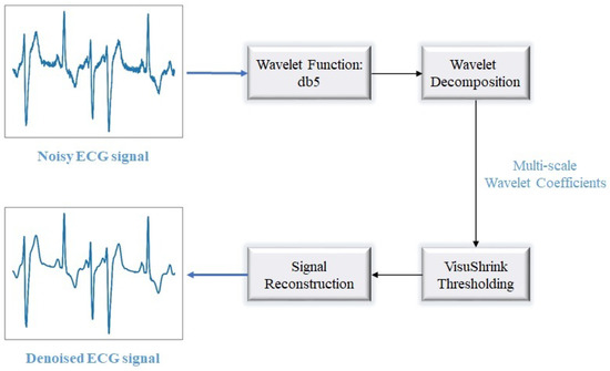 Accurate ECG Classification Based on Spiking Neural Network and ...