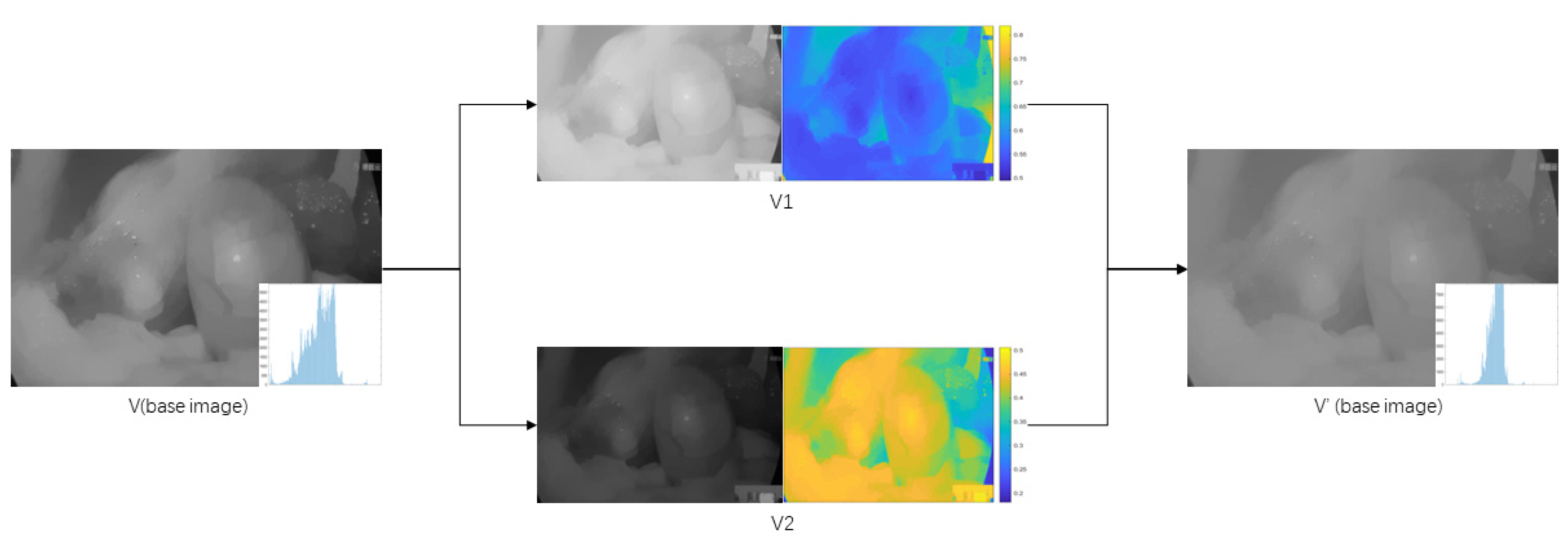 Electronics | Free Full-Text | An Endoscope Image Enhancement Algorithm ...