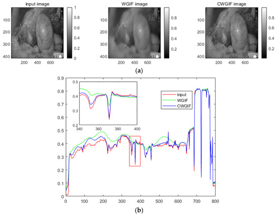 Computer Vision and Image Processing