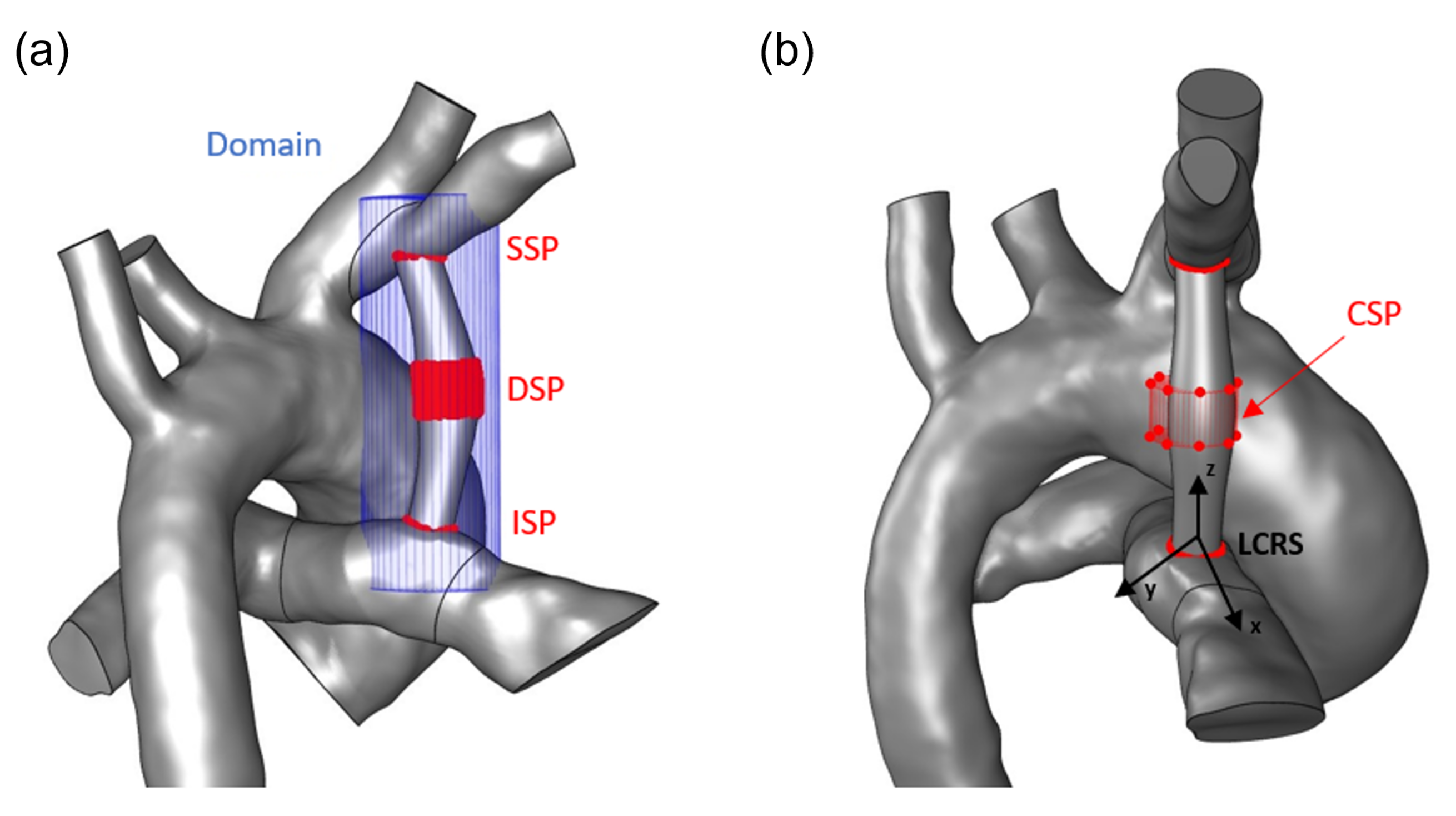 The Hemodynamic Effect of Modified Blalock–Taussig Shunt Morphologies ...