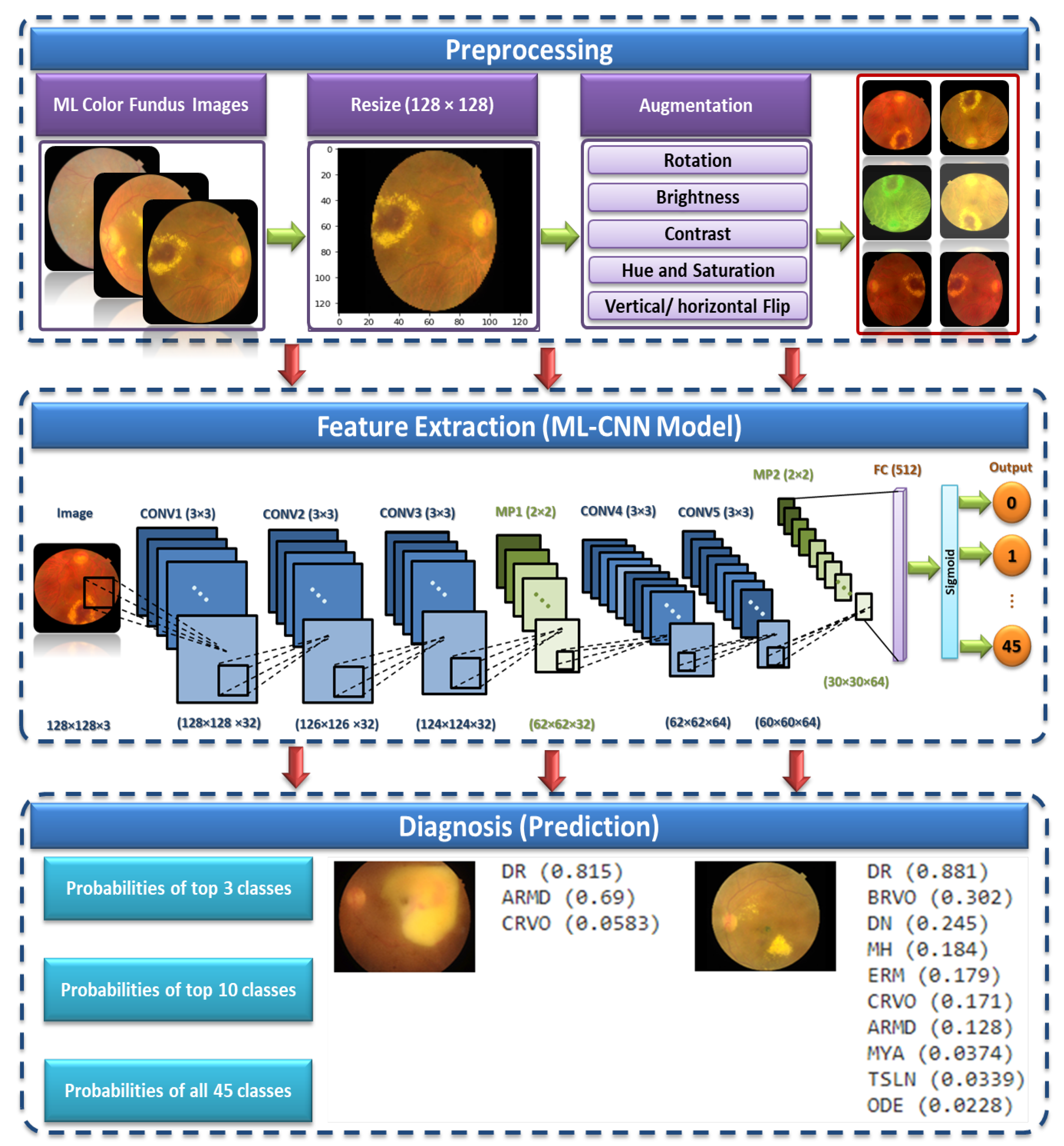 Electronics | Free Full-Text | Multiple Ocular Disease Diagnosis Using ...