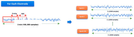 Electronics | Free Full-Text | Automatic Detection of Driver Fatigue Based on EEG Signals Using ...