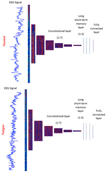 Electronics | Free Full-Text | Automatic Detection of Driver Fatigue Based on EEG Signals Using ...