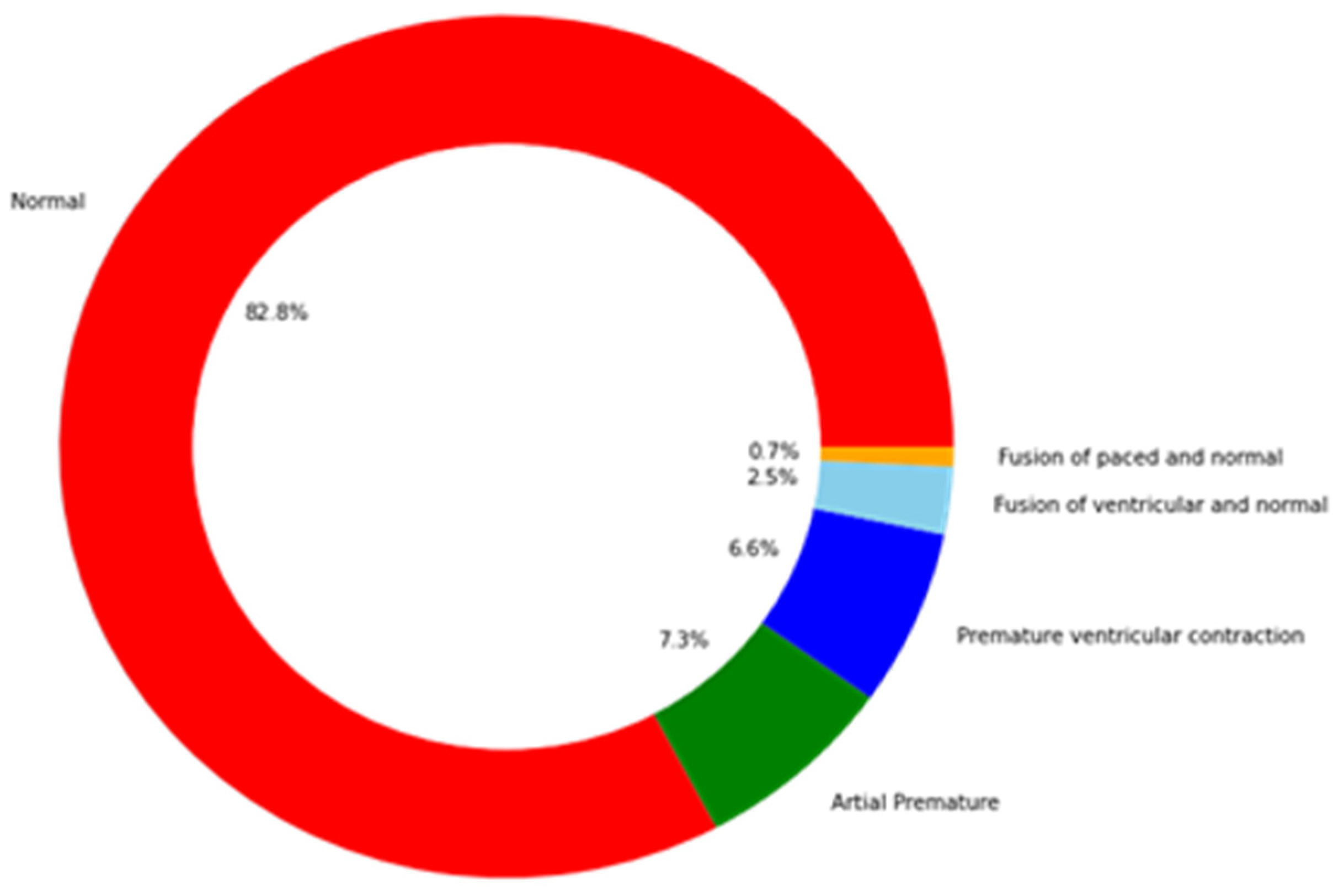 ECG Heartbeat Classification Using CONVXGB Model