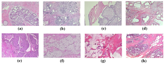 Breast Cancer Histopathological Image Recognition Based on Pyramid Gray ...