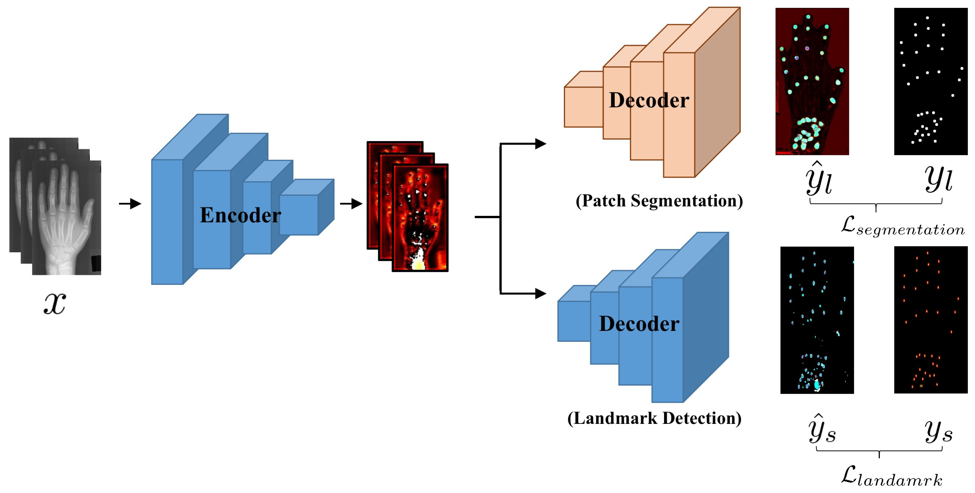 Anatomical Landmark Detection Using a Feature-Sharing Knowledge Distillation-Based Neural Network