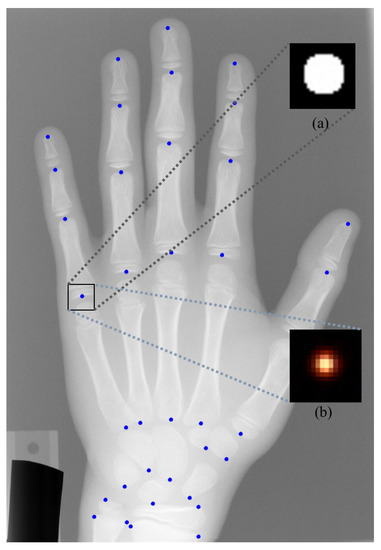 Anatomical Landmark Detection Using a Feature-Sharing Knowledge Distillation-Based Neural Network