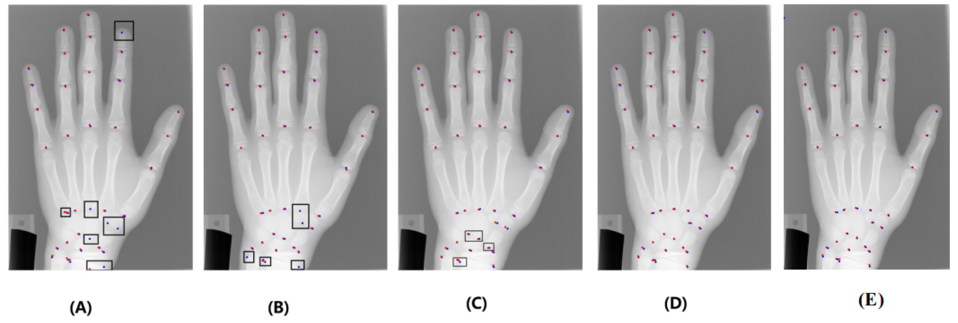 Anatomical Landmark Detection Using a Feature-Sharing Knowledge Distillation-Based Neural Network