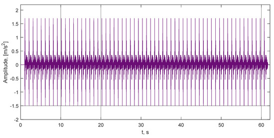 A Novel Seismocardiogram Mathematical Model for Simplified Adjustment ...