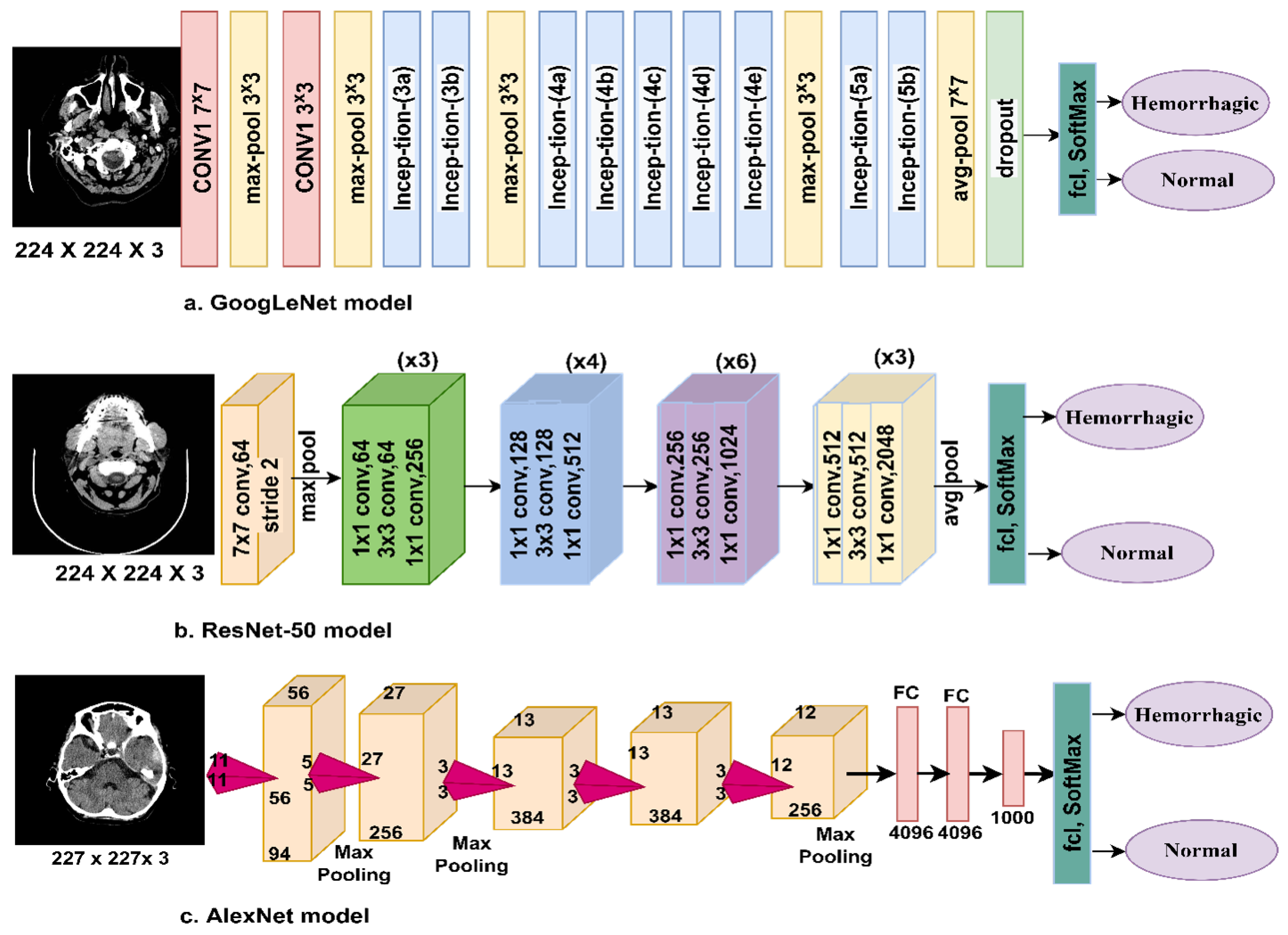 Electronics | Free Full-Text | Multi-Method Diagnosis of CT Images for ...