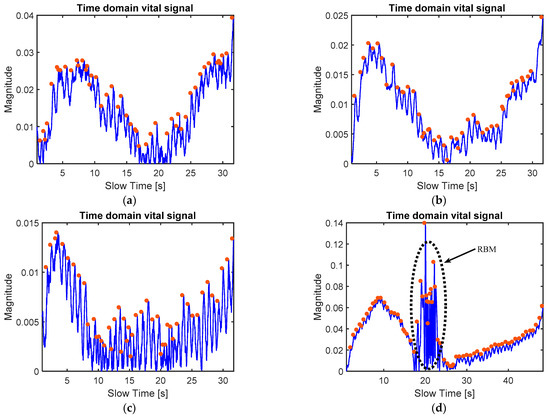 IR-UWB Radar-Based Robust Heart Rate Detection Using a Deep Learning Technique Intended for ...